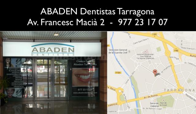 Abaden Dentistas Tarragona - Dentista